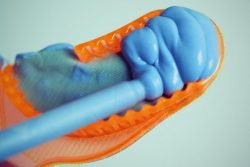 The dual arch impression taking